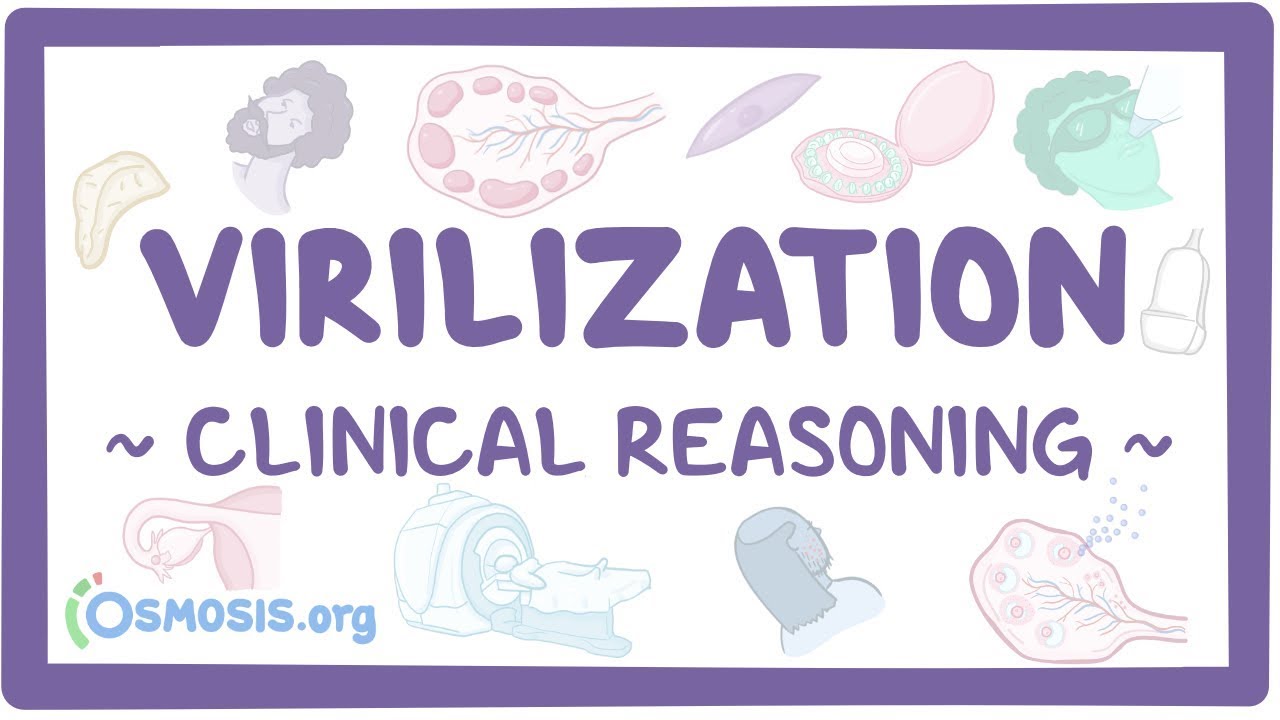 Virilization: Clinical: Video, Causes, & Meaning | Osmosis