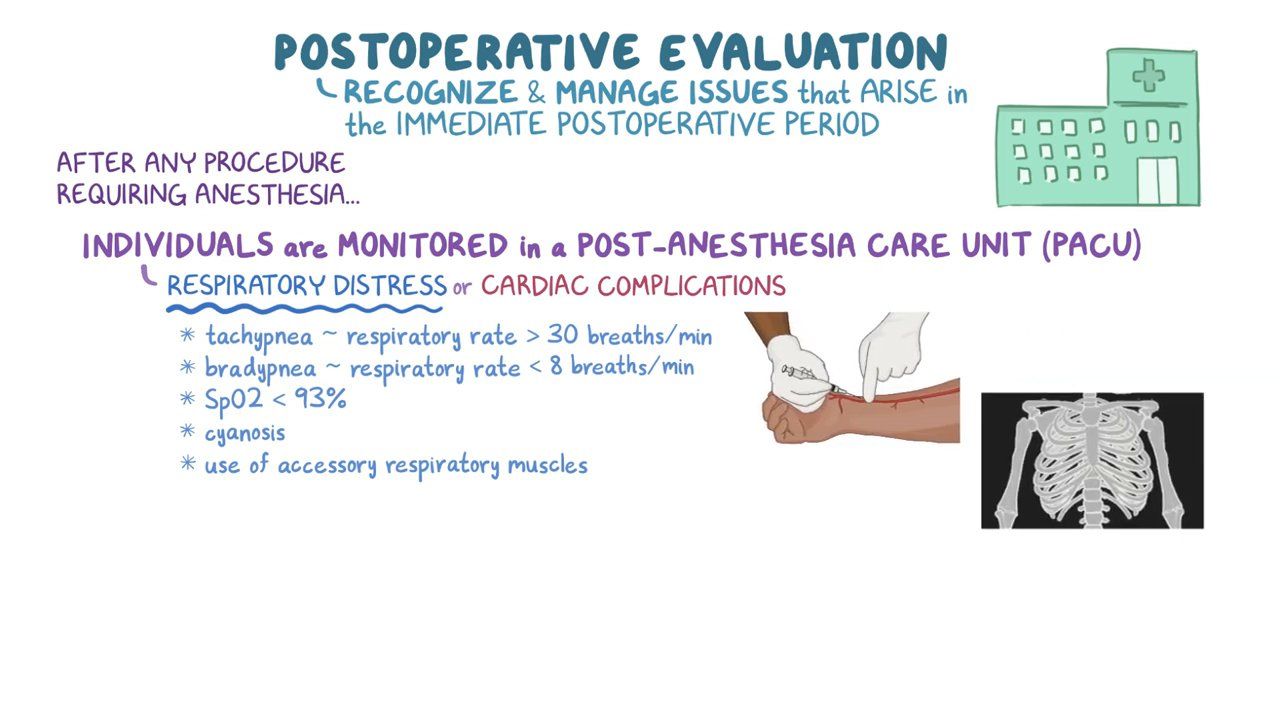 Postoperative evaluation: Clinical: Video & Anatomy | Osmosis
