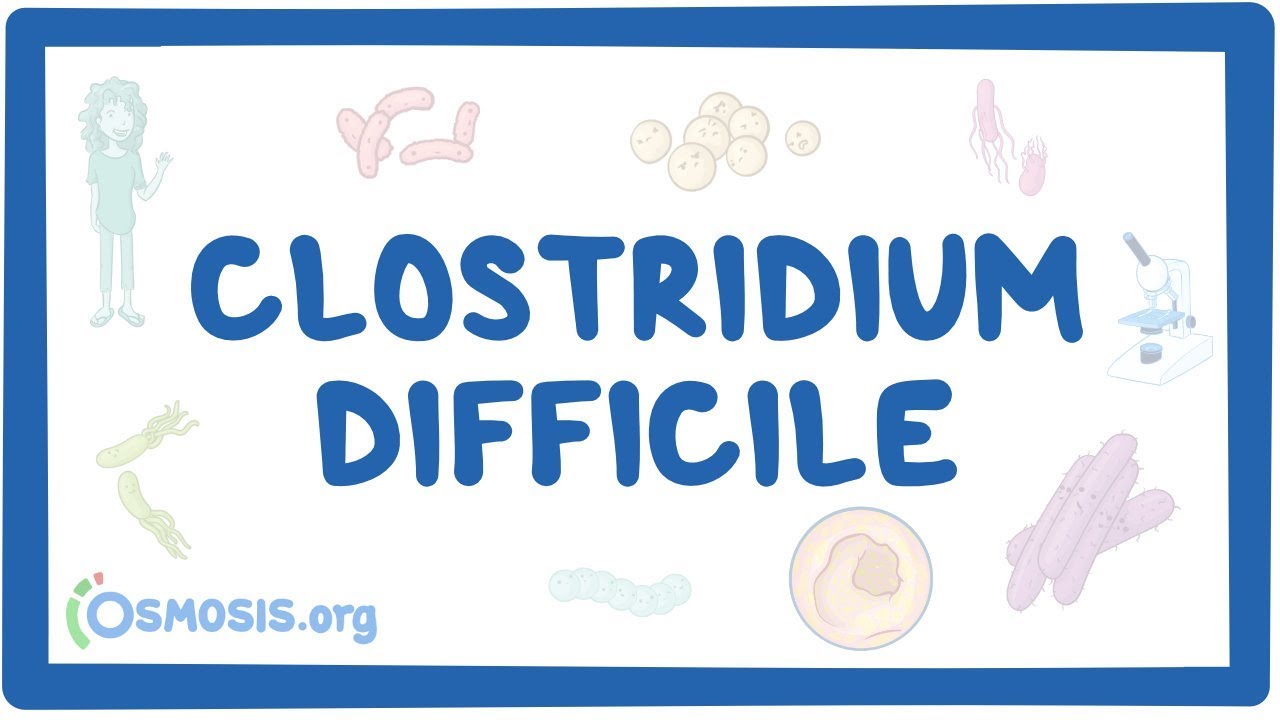 Clostridium difficile (Pseudomembranous colitis): Video, Causes ...