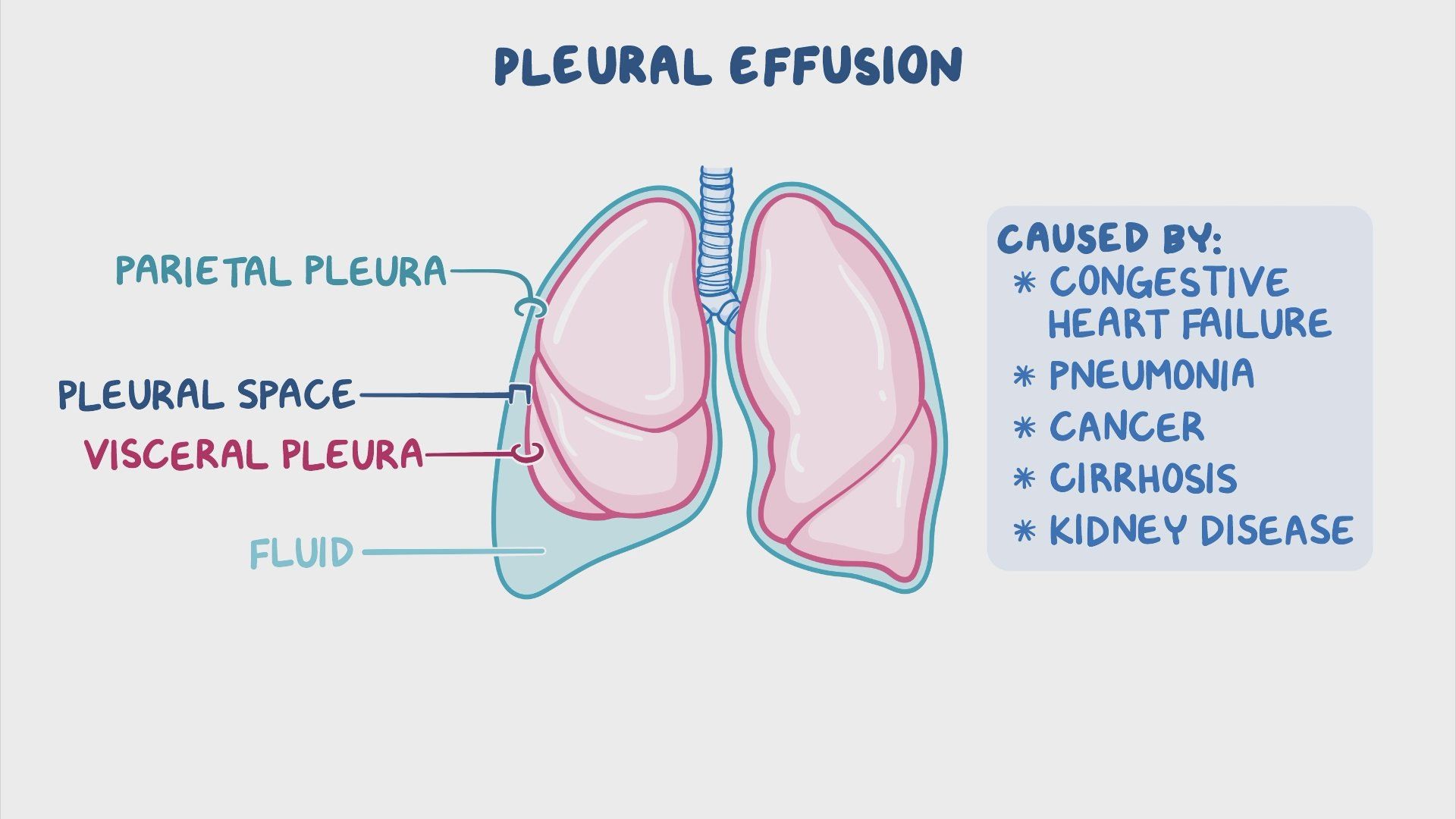Parietal Pleura Parietal Pleura