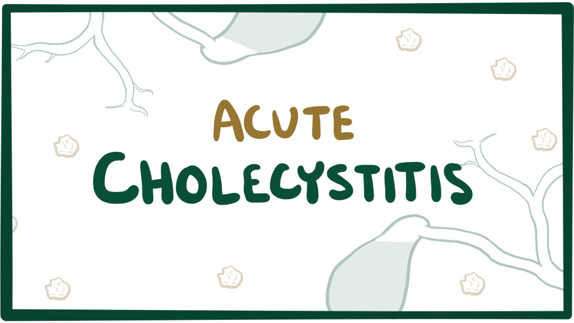 Acute cholecystitis - Osmosis Video Library