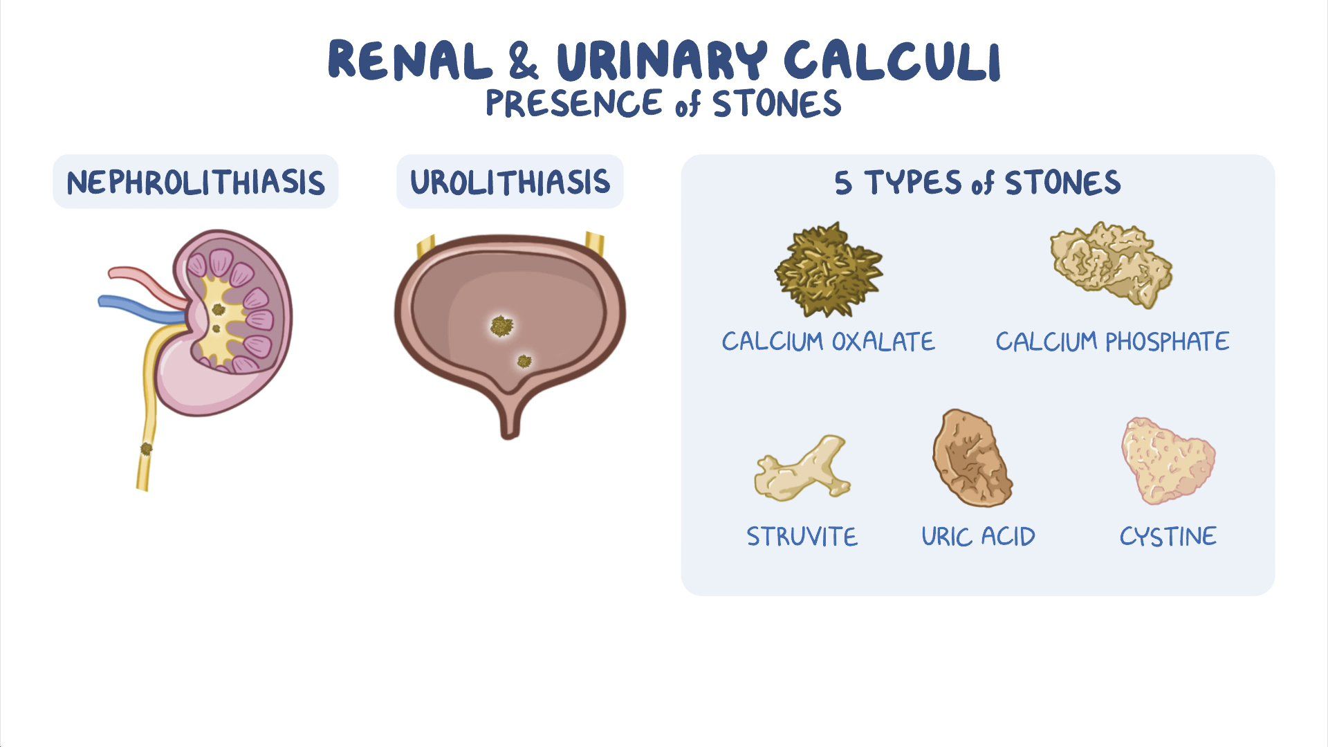 Calculus Medical Term