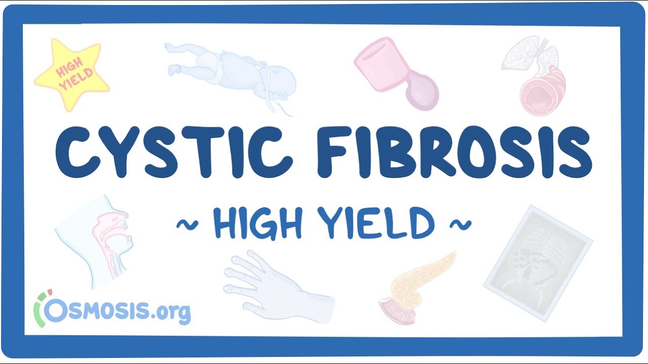 Cystic fibrosis: Pathology review: Video, Causes, & Meaning | Osmosis