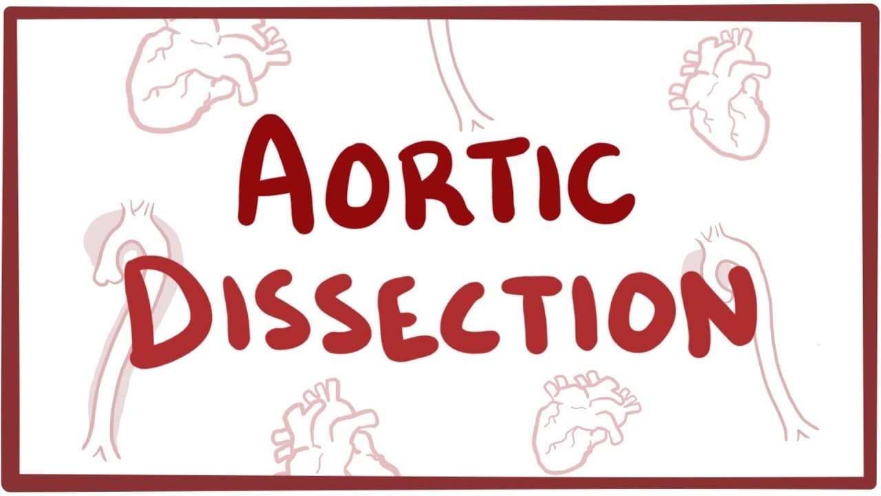 Aortic dissection: Video, Causes, & Meaning | Osmosis