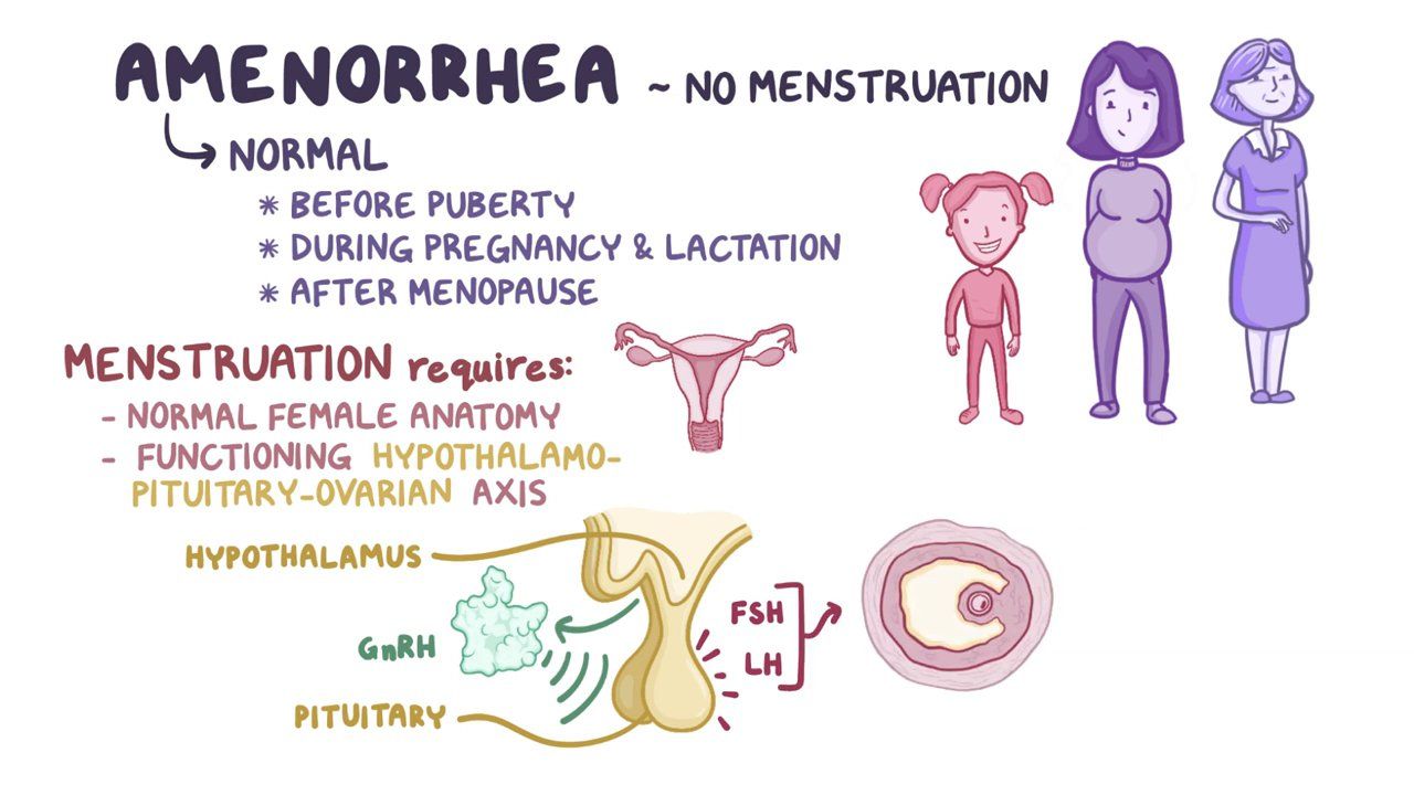 Amenorrhea