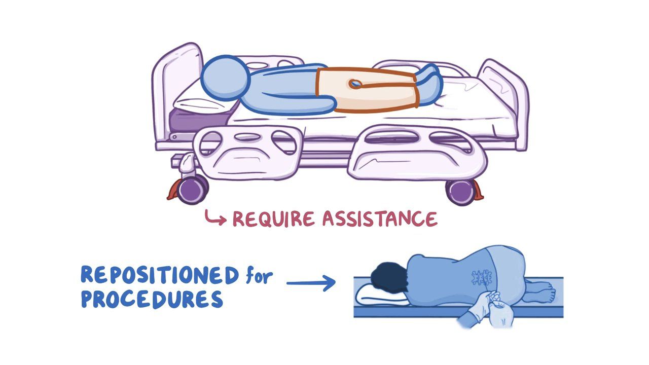 Repositioning clients (for nursing assistant training) - Osmosis Video ...