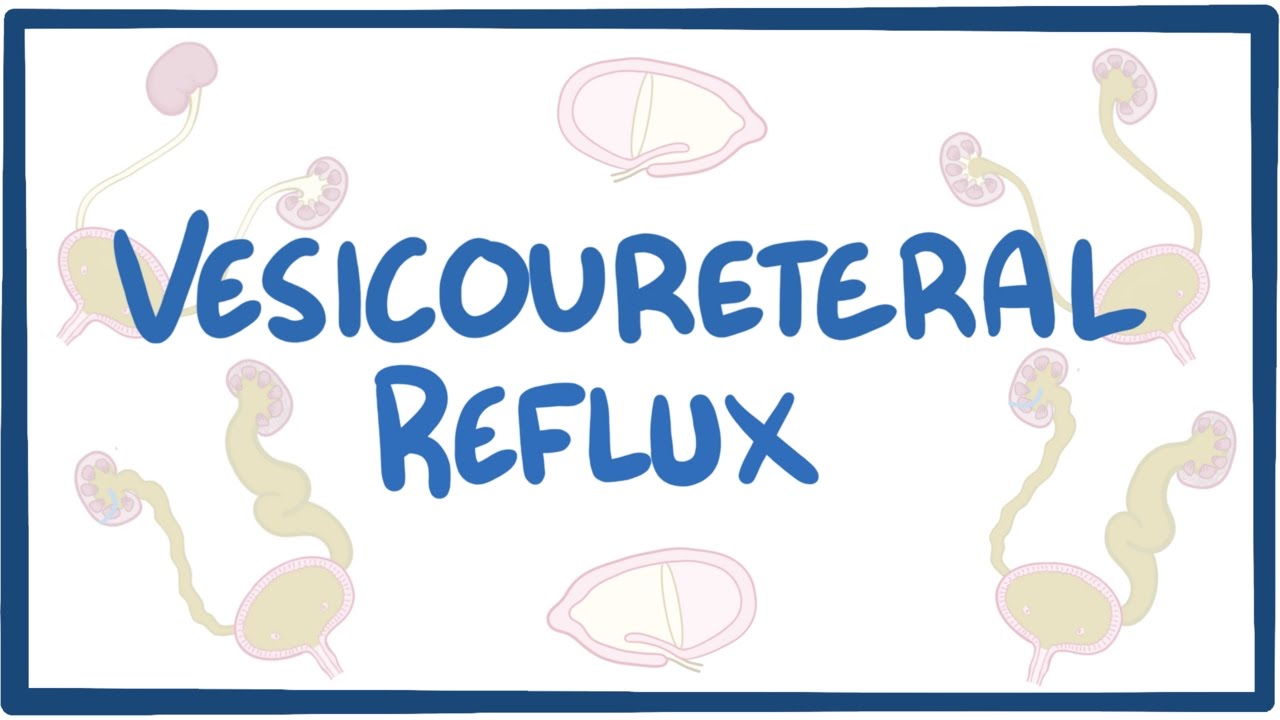Vesicoureteral reflux: Video, Causes, & Meaning | Osmosis