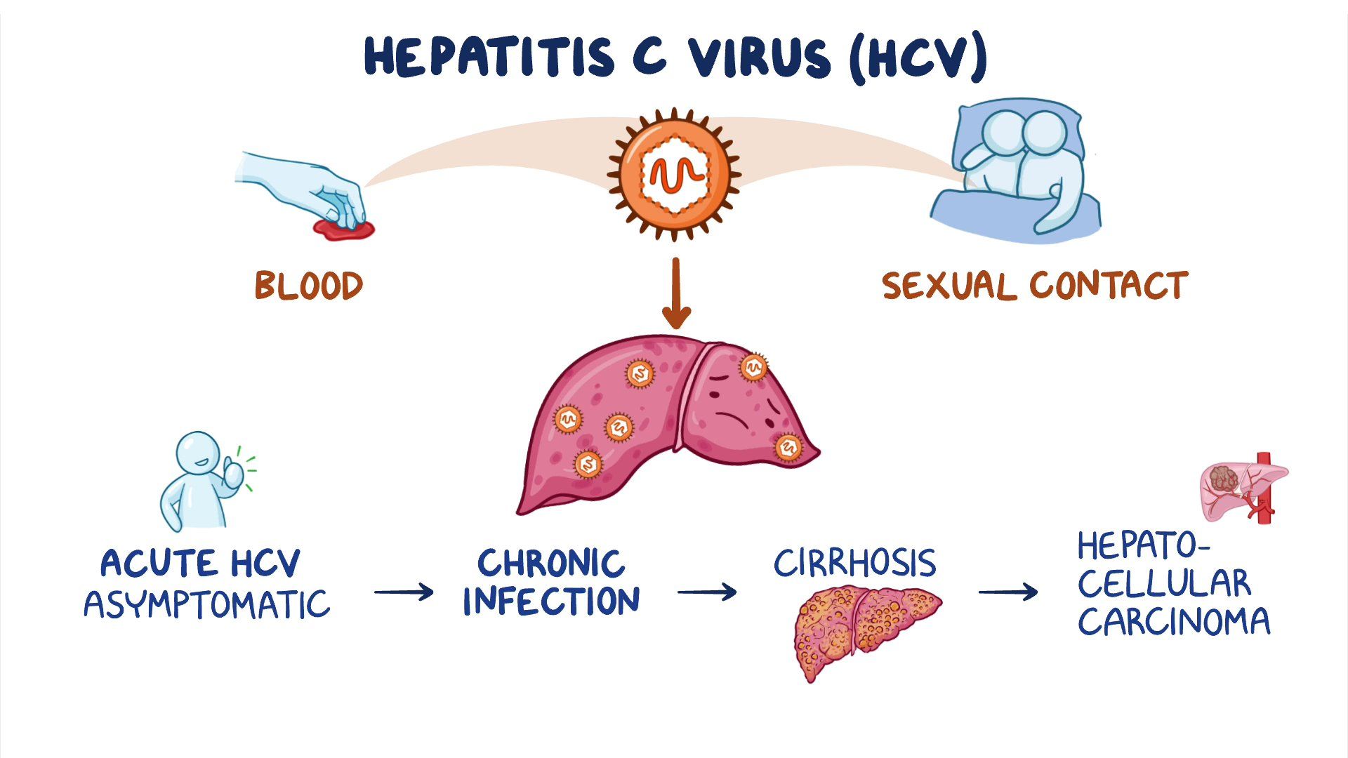 Hepatitis C Clinical Sciences Osmosis Video Library