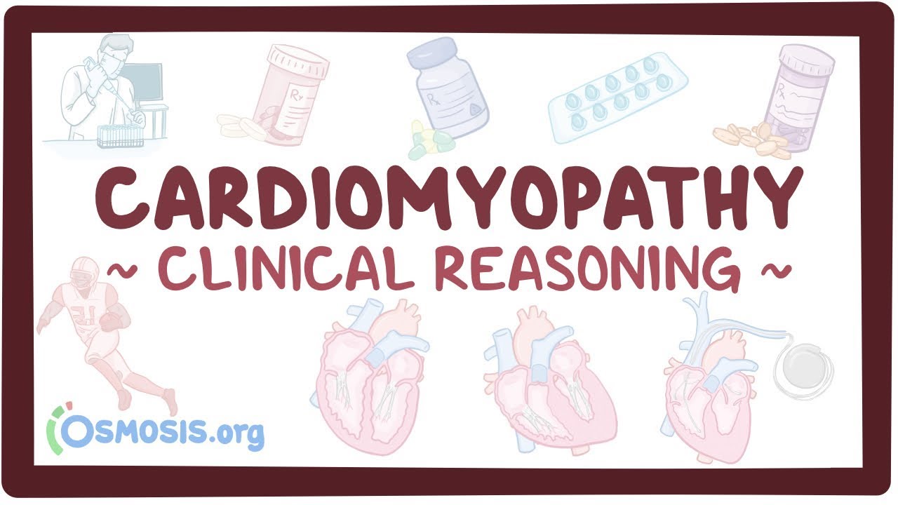 Cardiomyopathies: Clinical: Video, Causes, & Meaning | Osmosis