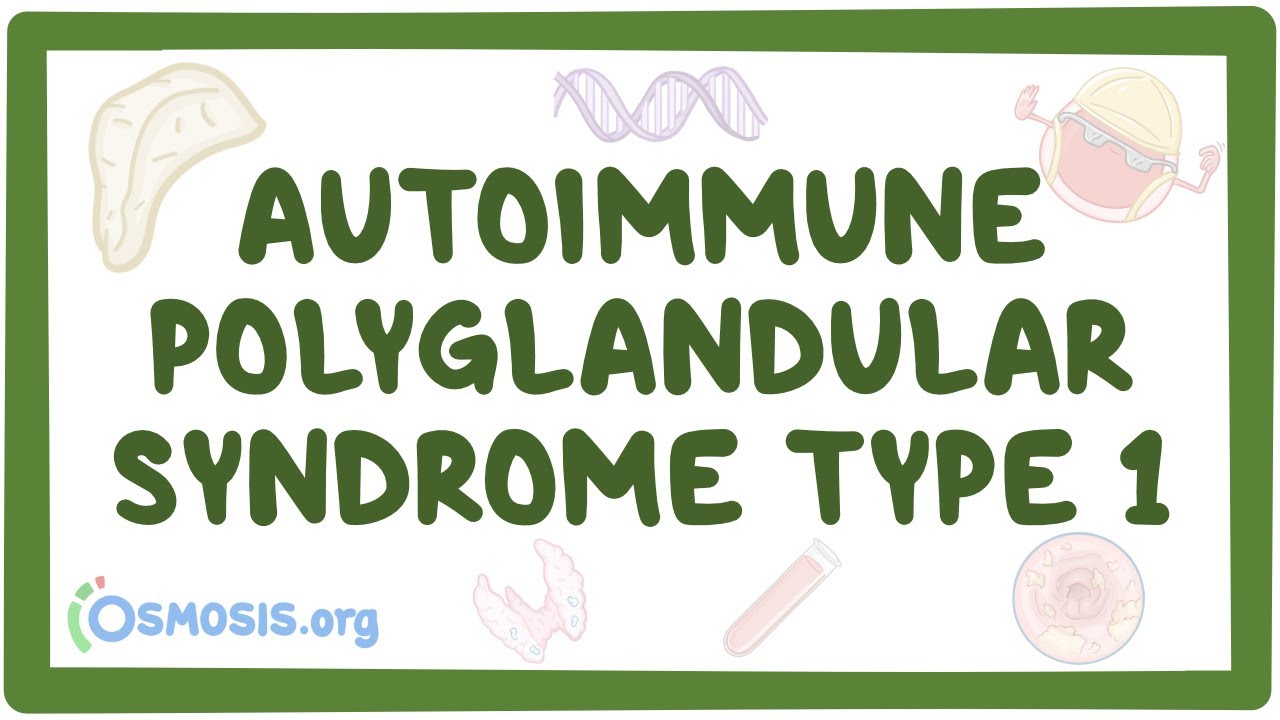 Autoimmune polyglandular syndrome type 1 (NORD): Video, Causes ...