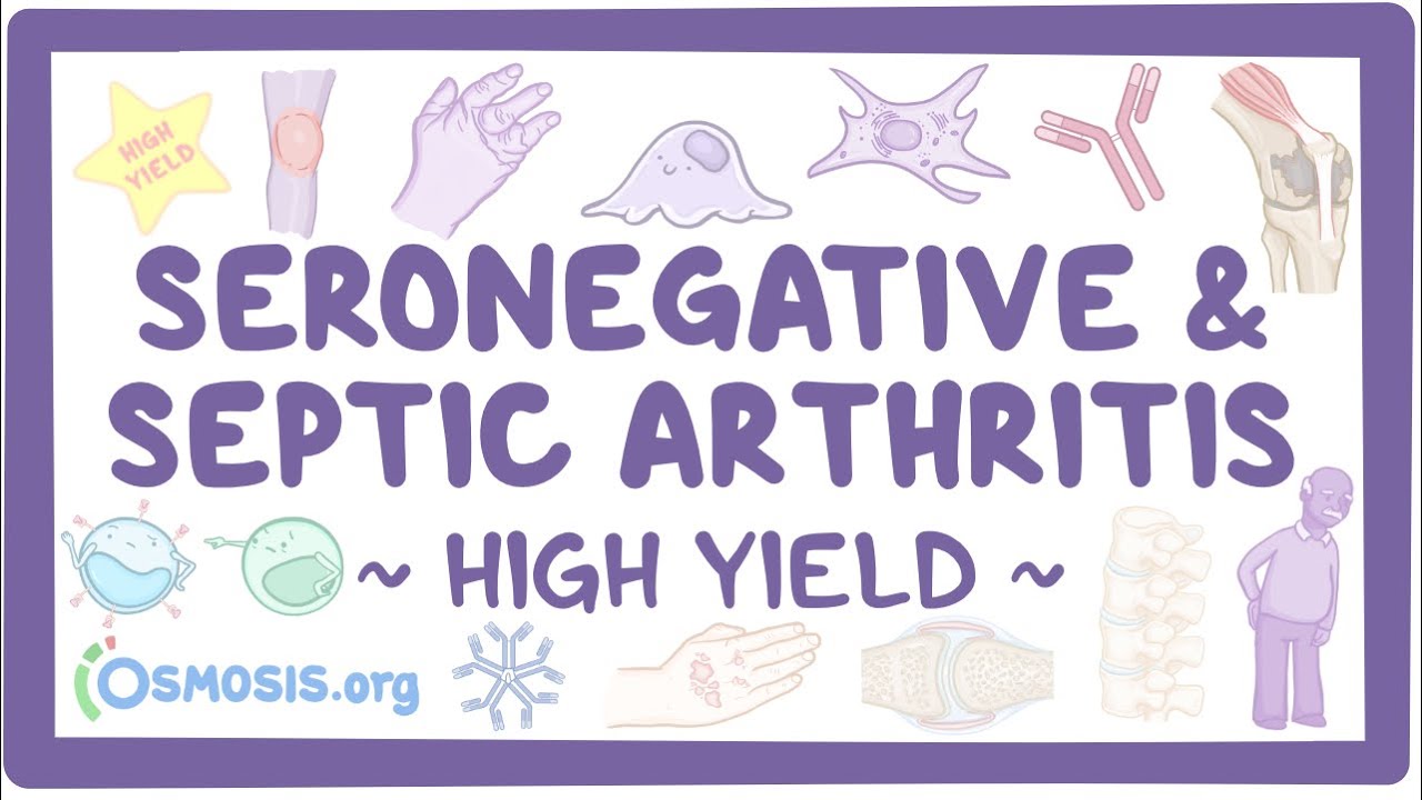 Seronegative and septic arthritis: Pathology review: Video, Causes ...