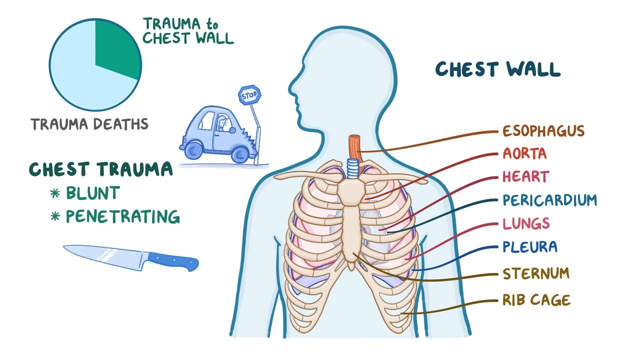 Chest Trauma Clinical Video Anatomy Definition Osmosis Chest Trauma Clinical Video Anatomy Definition Osmosis