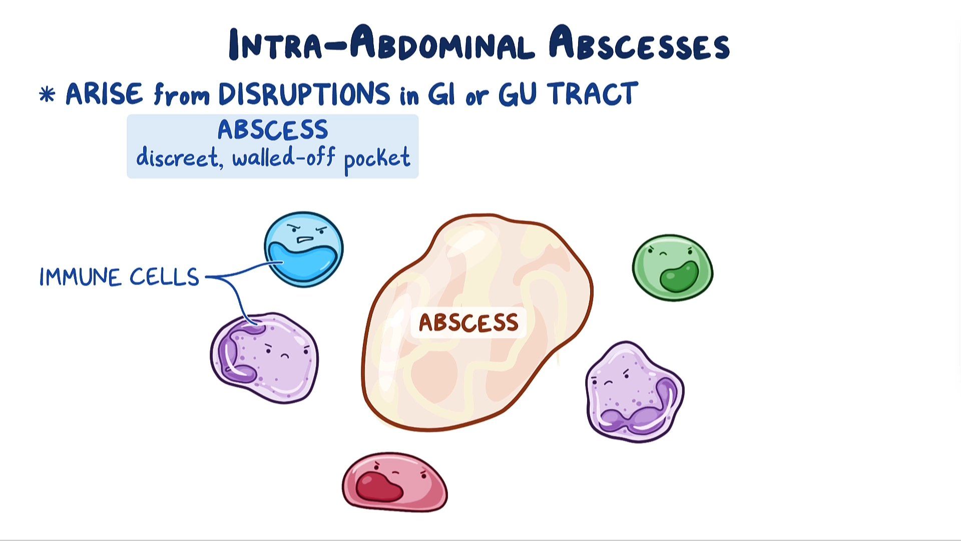 Intra Abdominal Abscess Intra Abdominal Abscess
