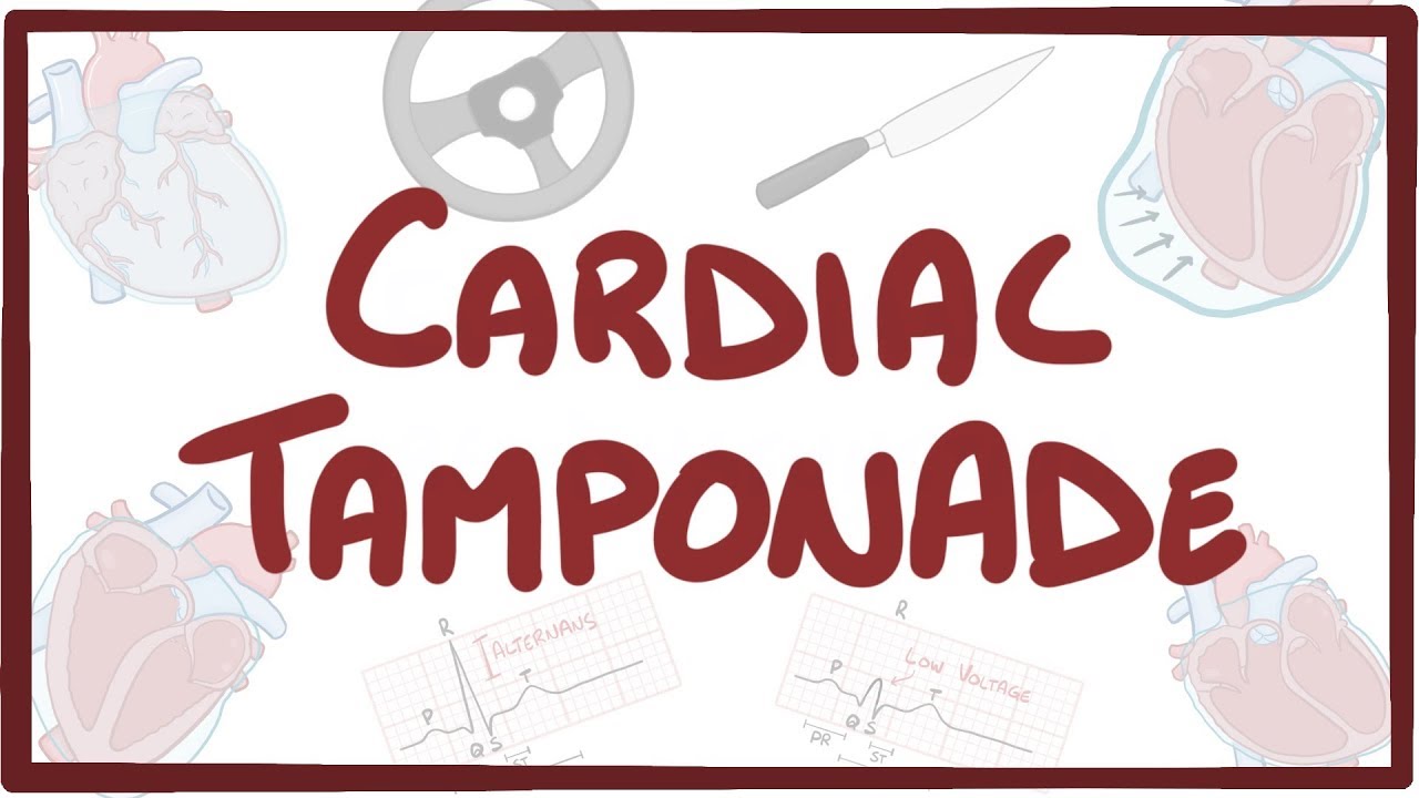 Cardiac tamponade: Video, Causes, & Meaning | Osmosis