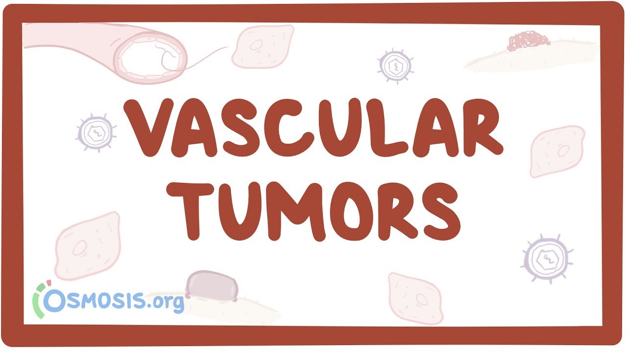 Vascular tumors: Video, Causes, & Meaning | Osmosis