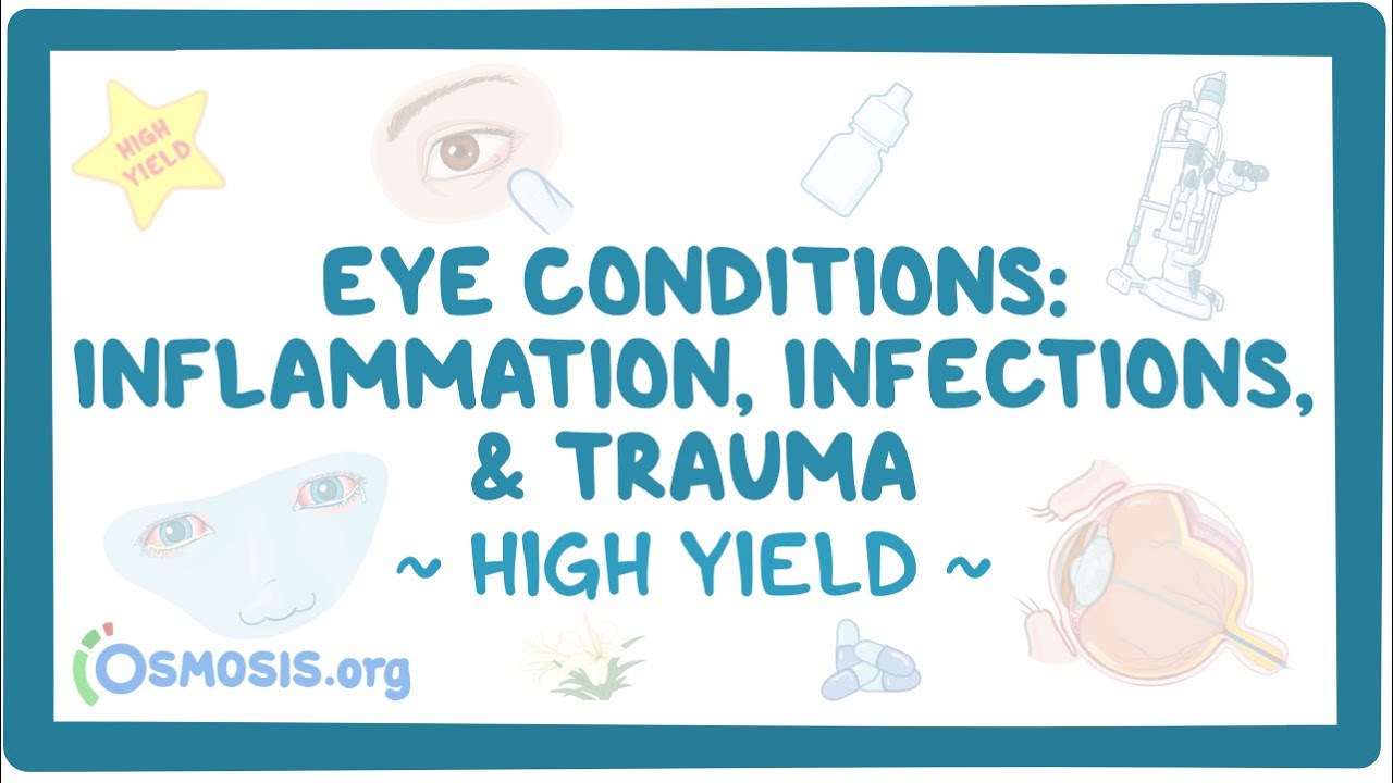 Eye conditions: Inflammation, infections and trauma: Pathology review ...