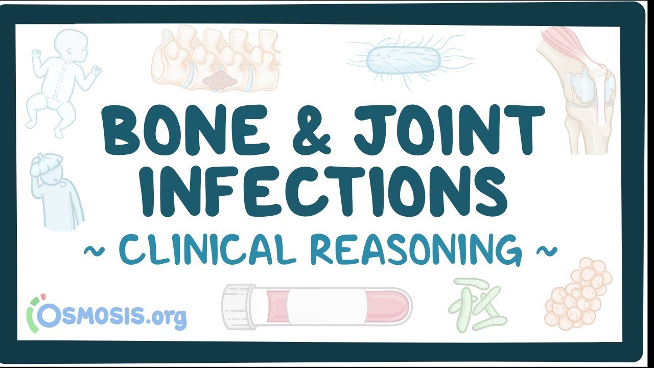 Pediatric bone and joint infections: Clinical: Video, Causes, & Meaning ...