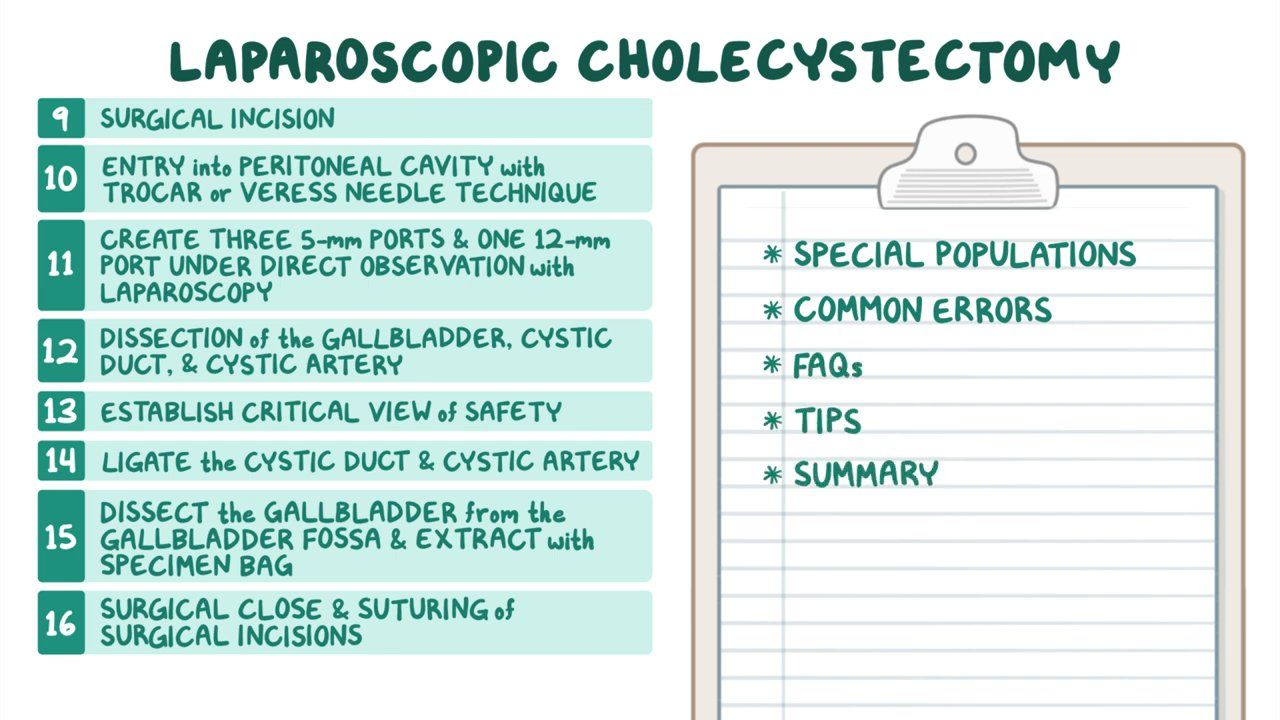Laparoscopic Cholecystectomy Laparoscopic Cholecystectomy