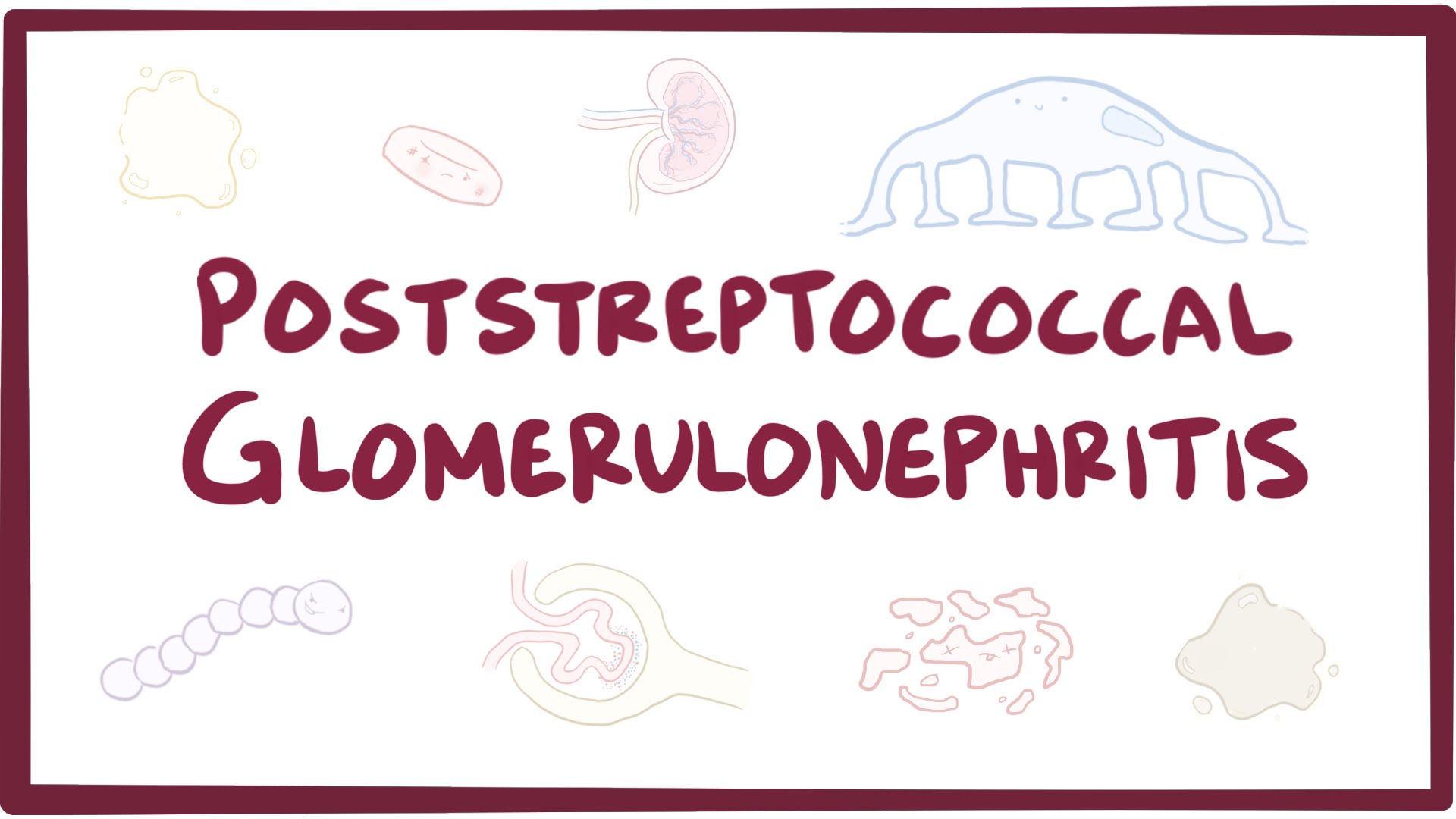 Glomerulonefritis Postestreptoc cica V deo Osmosis