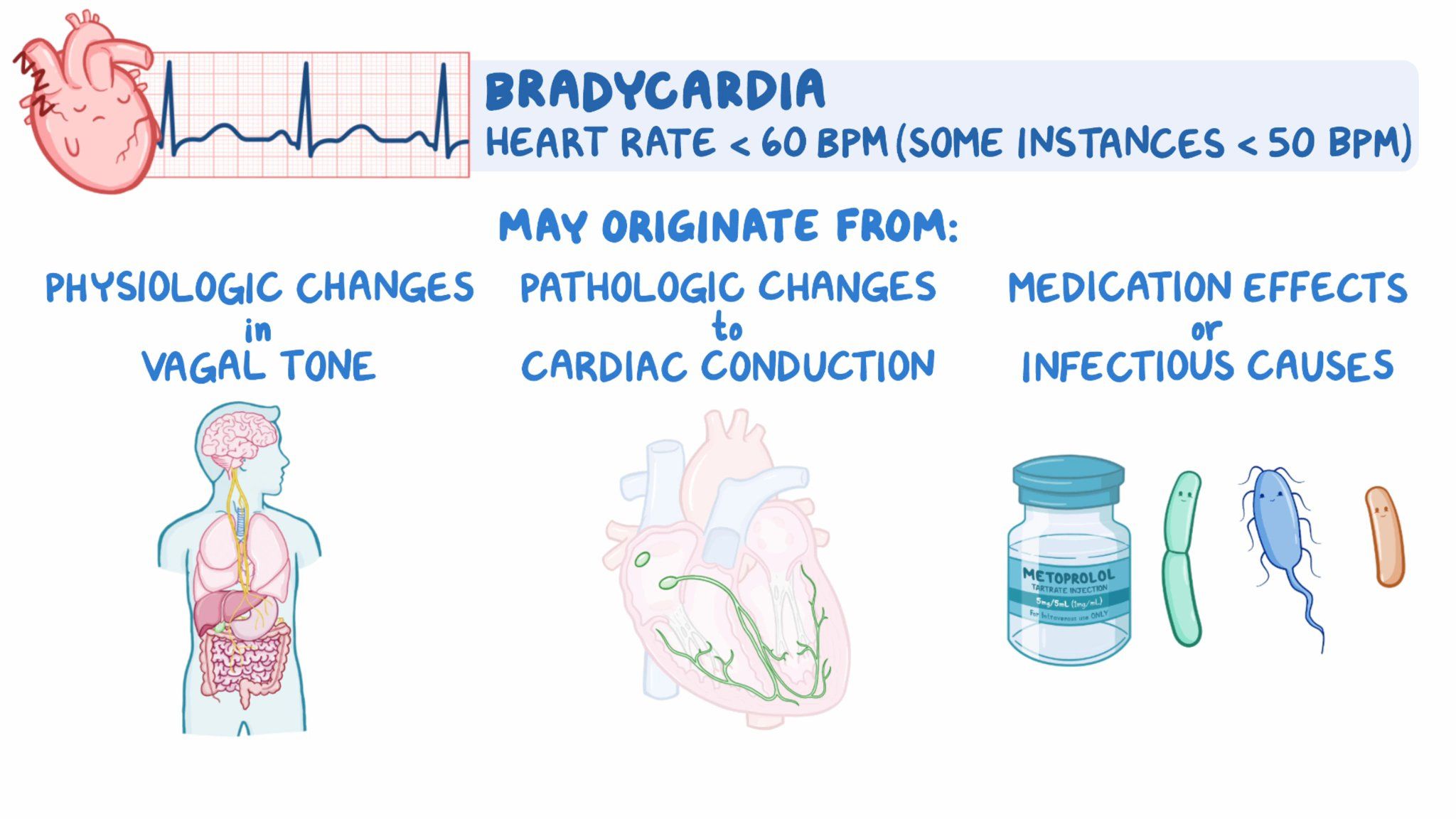 Approach To Bradycardia Clinical Sciences Osmosis Video Library