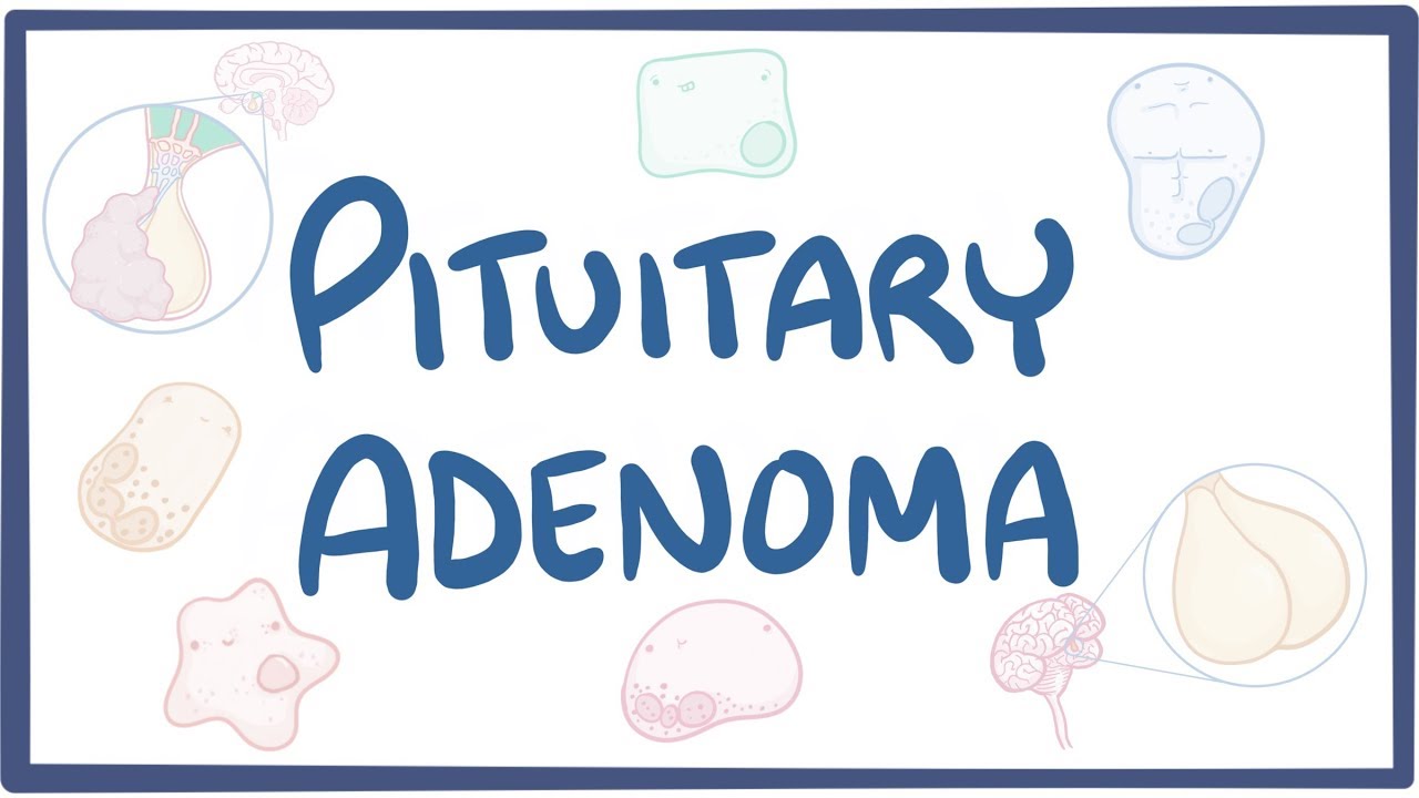 Adenoids Definition