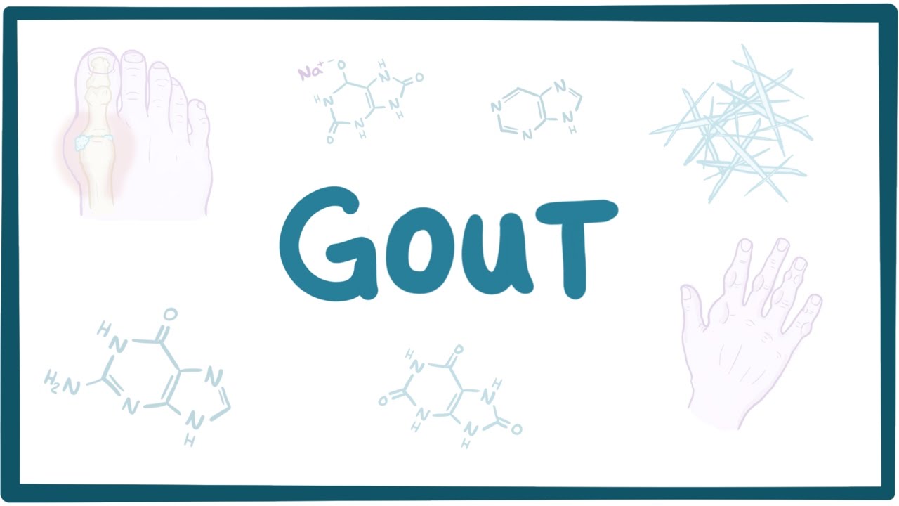 Gout: Video, Causes, & Meaning | Osmosis