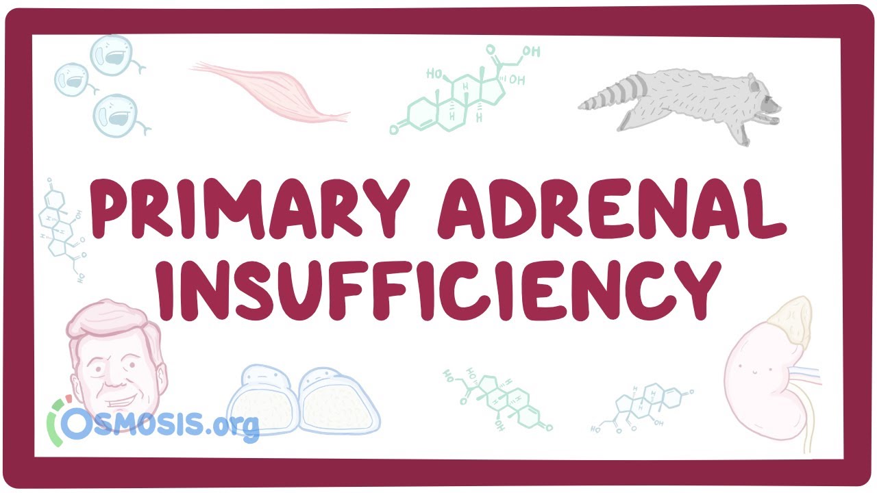 Primary adrenal insufficiency: Video, Causes, & Meaning | Osmosis