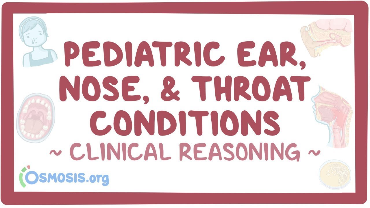 Pediatric ear, nose, and throat conditions: Clinical: Video, Causes ...
