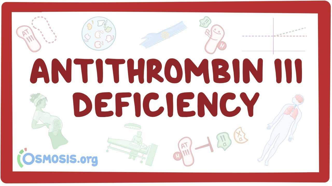 Antithrombin III deficiency: Video, Causes, & Meaning | Osmosis