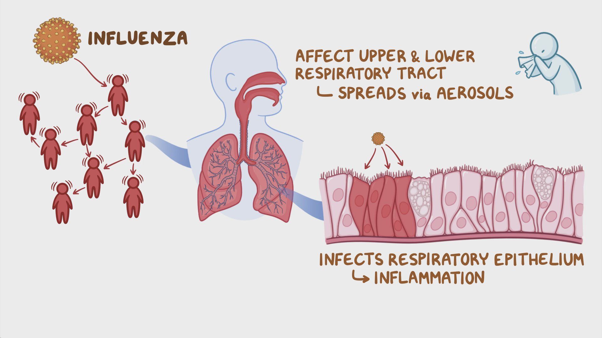 Influenza Clinical Sciences Osmosis Video Library