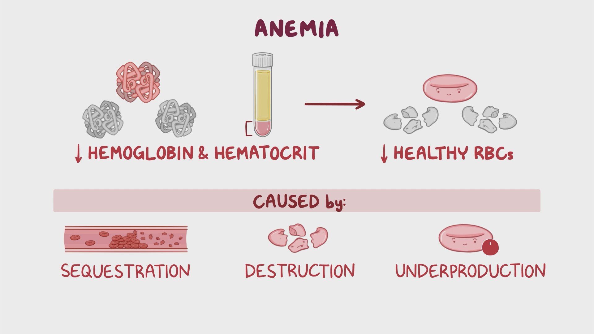 Approach to anemia (underproduction): Clinical sciences - Biblioteca de ...