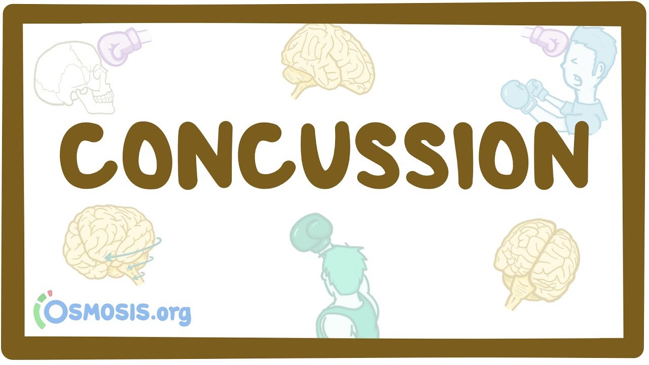 Concussion and traumatic brain injury: Video, Causes, & Meaning | Osmosis