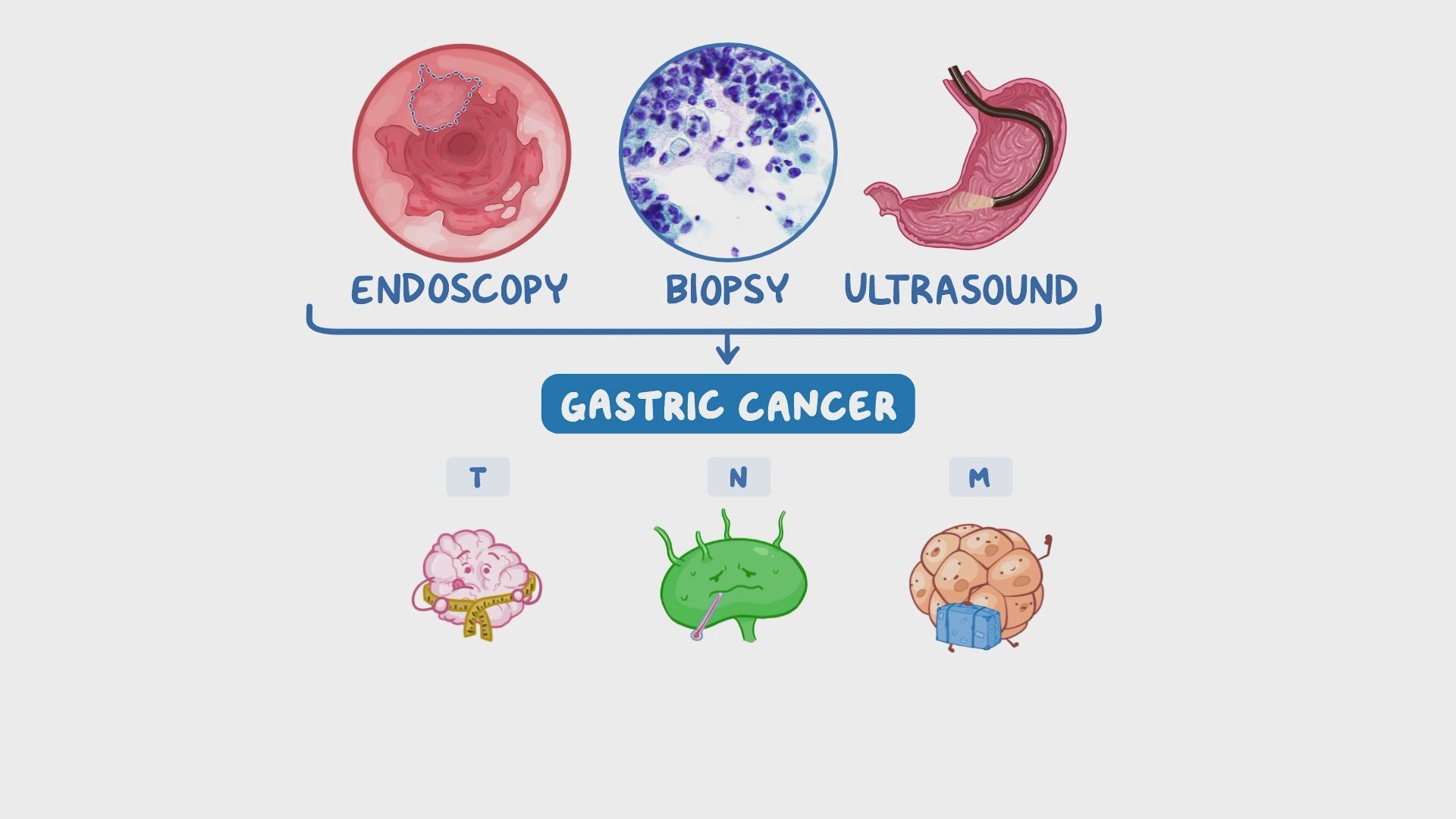 Gastric cancer: Clinical sciences - Osmosis Video Library
