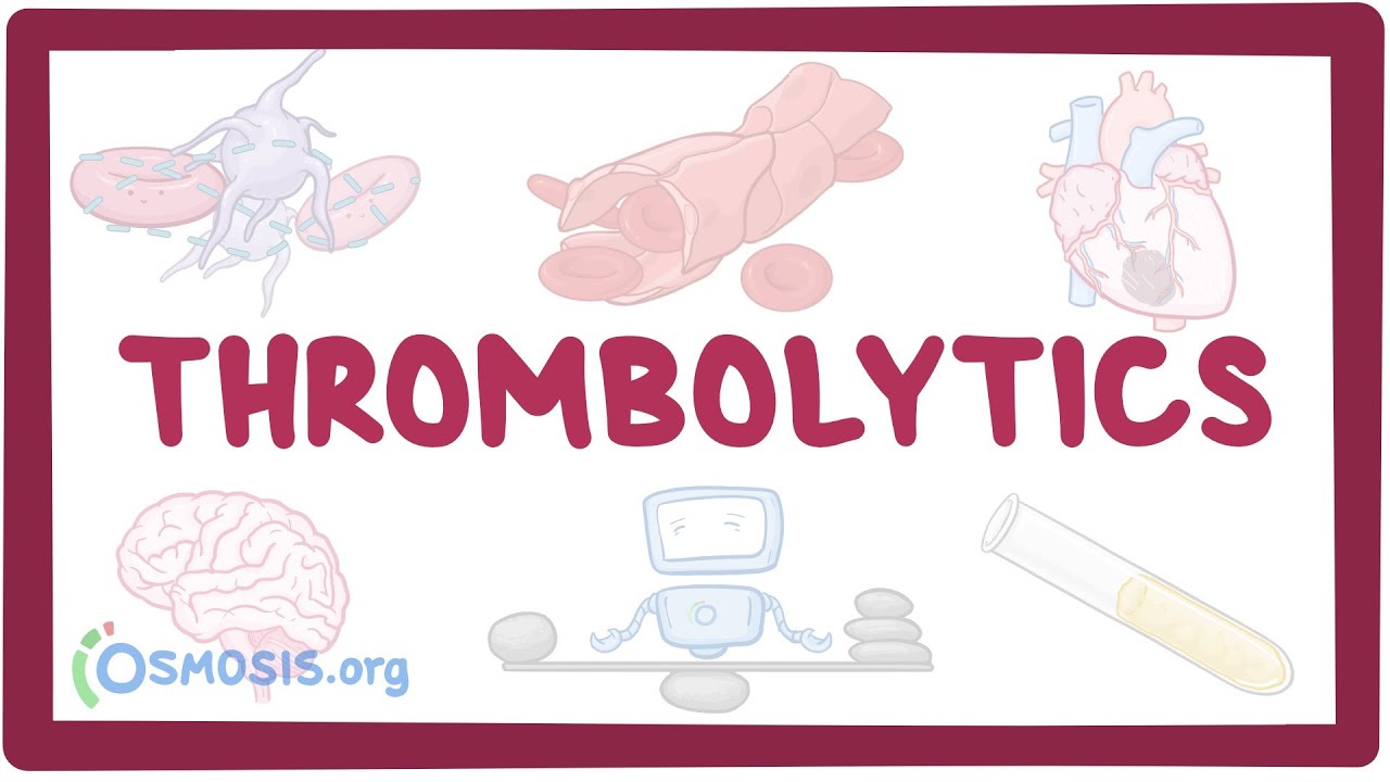 Thrombolytics: Video, Causes, & Meaning | Osmosis