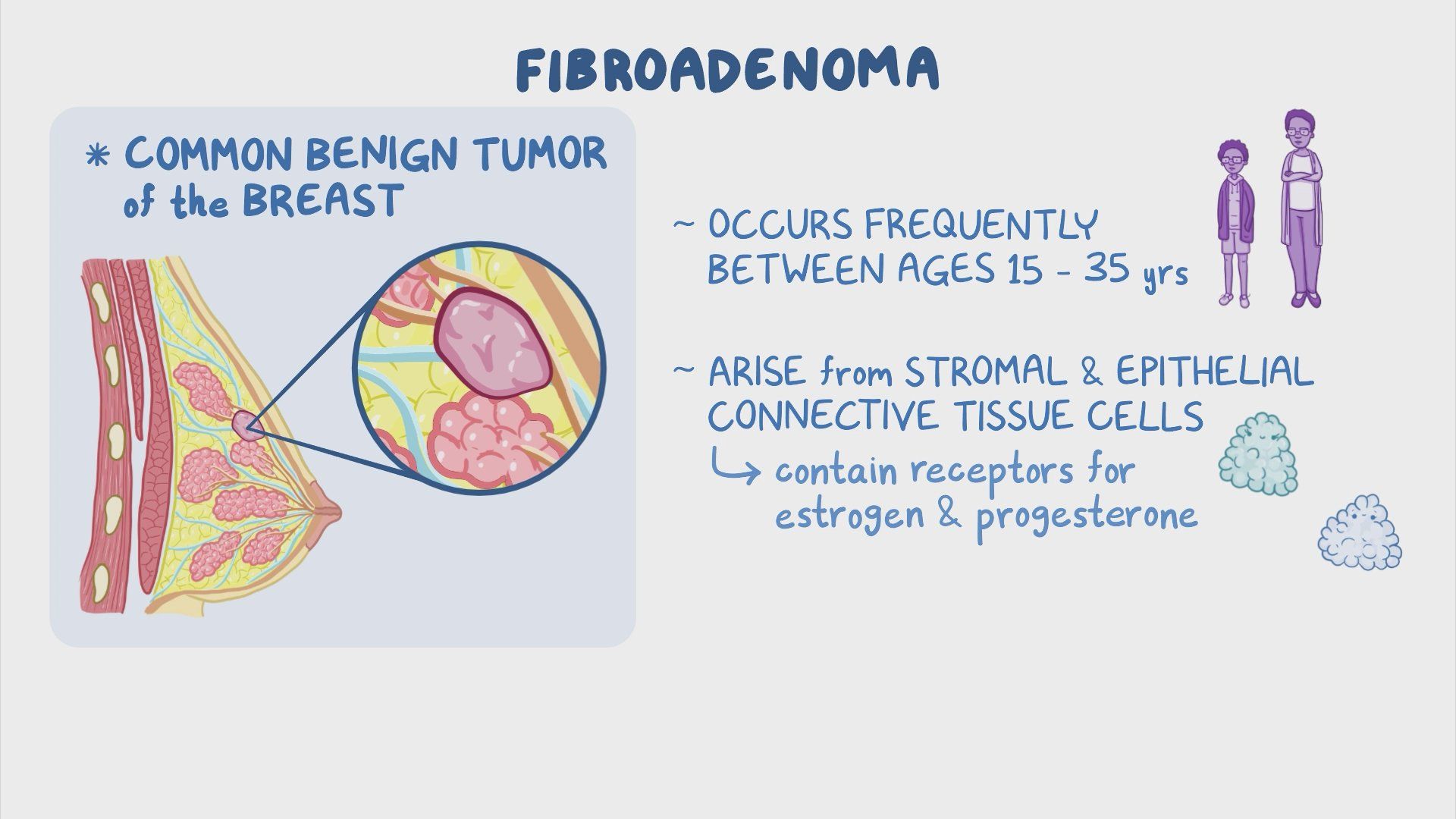 Fibroadenoma Clinical Sciences Osmosis Video Library Fibroadenoma Clinical Sciences Osmosis Video Library