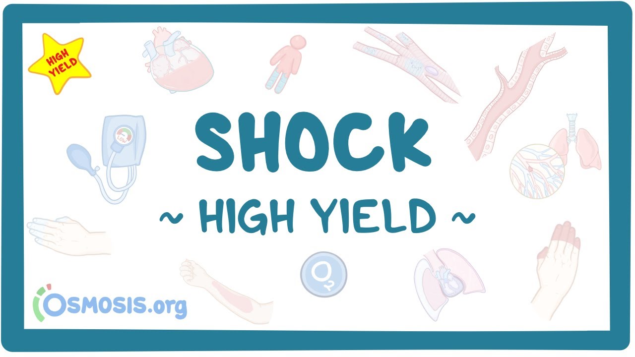 Shock: Pathology review: Video, Causes, & Meaning | Osmosis