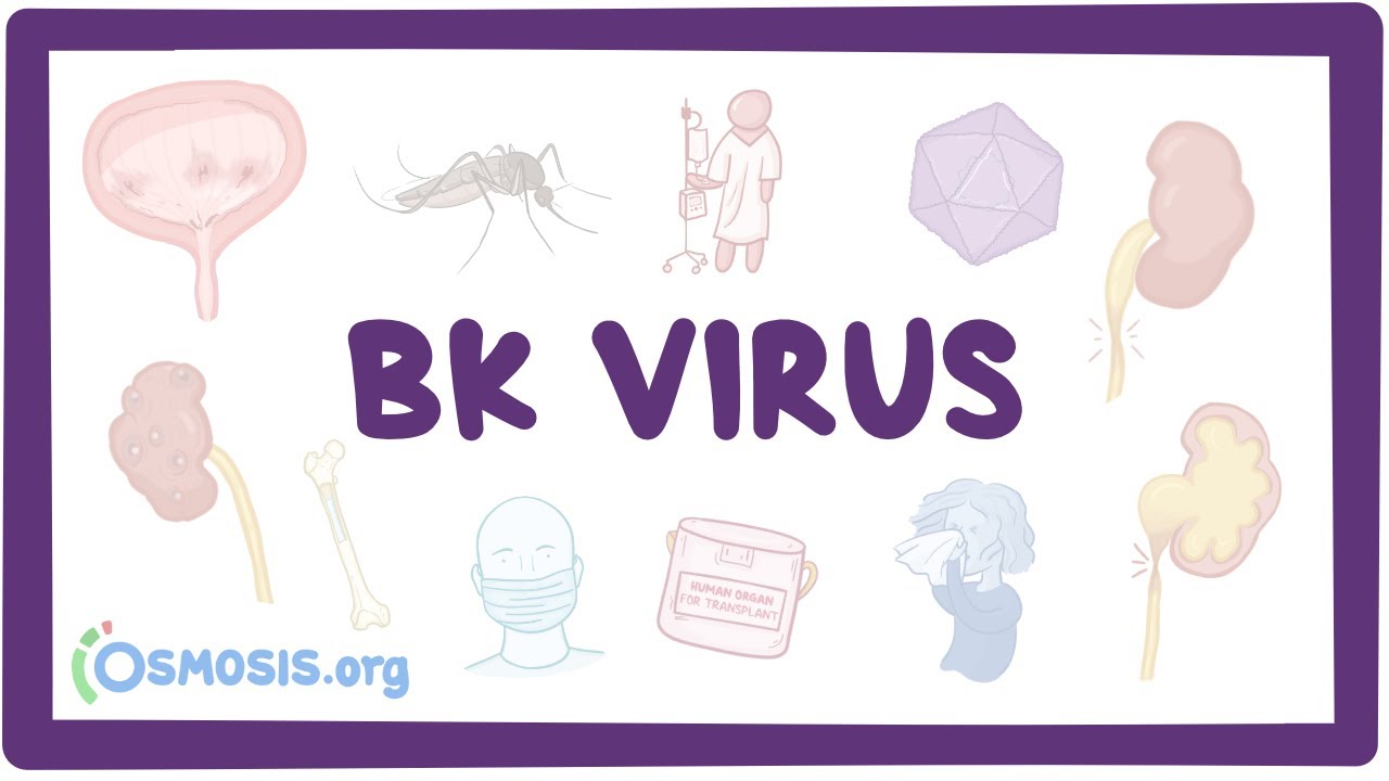 BK Virus Hemorrhagic Cystitis Video Anatomy Osmosis