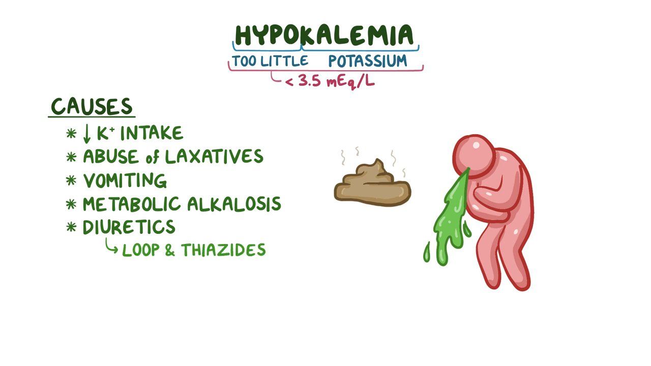 Hypokalemia Hypokalemia