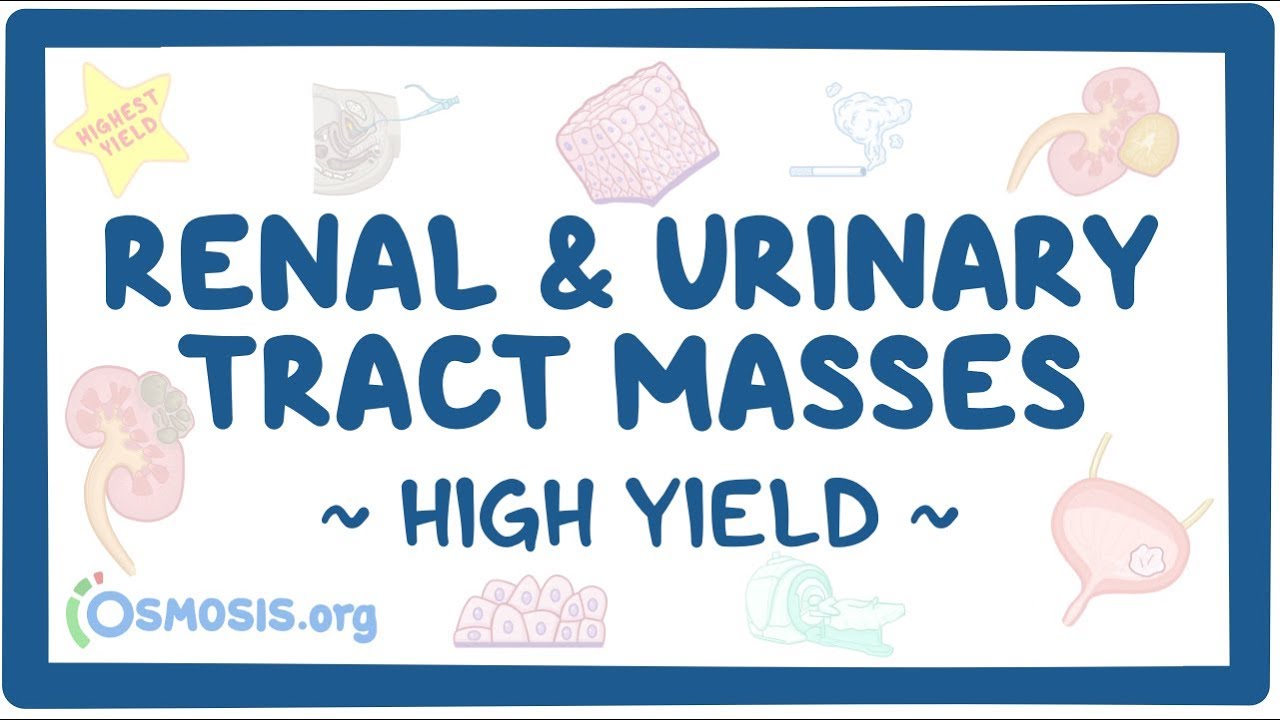 Renal and urinary tract masses: Pathology review: Video, Causes ...