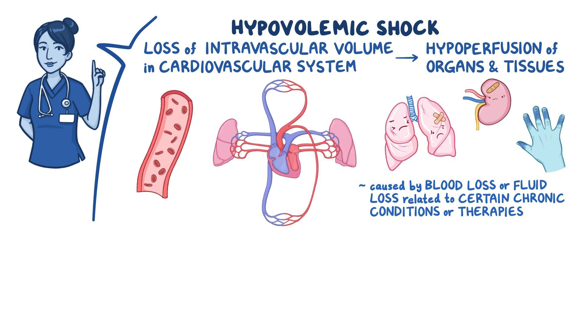 Shock Hypovolemic Nursing Osmosis Video Library Shock Hypovolemic Nursing Osmosis Video Library