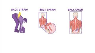Musculoskeletal system