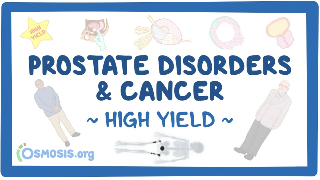 Prostate disorders and cancer: Pathology review: Video, Causes ...