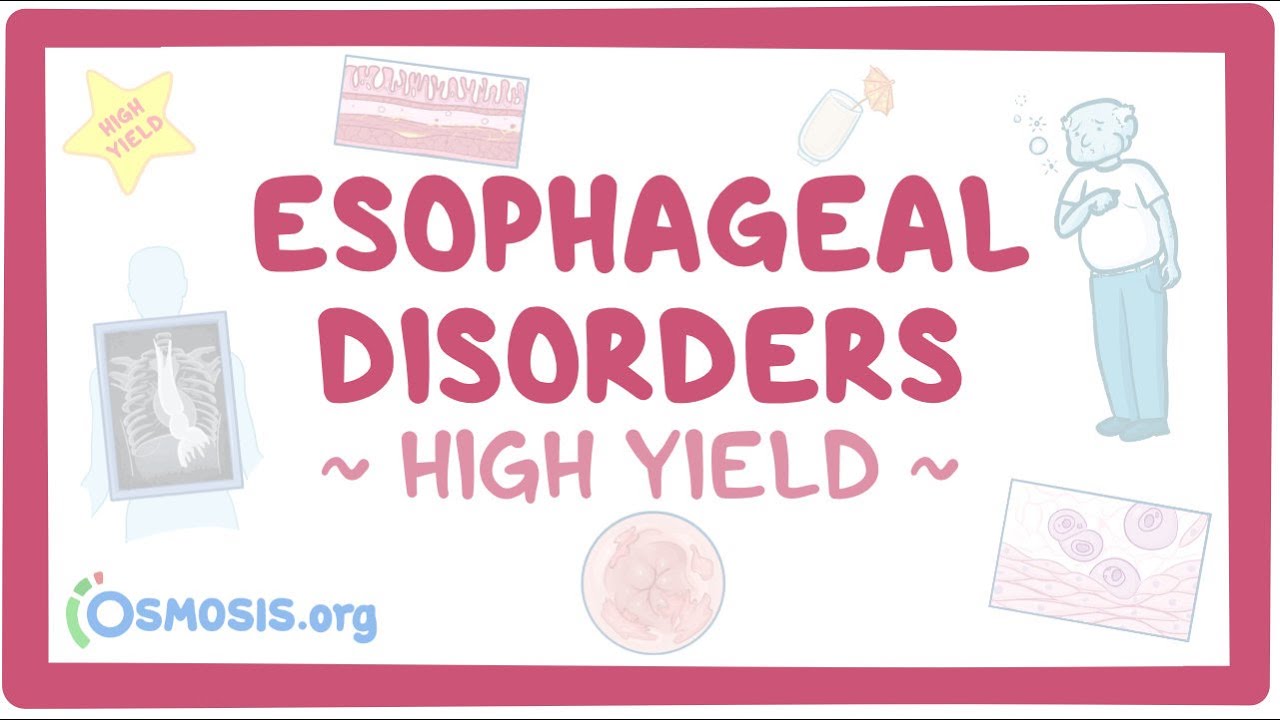 Esophageal disorders: Pathology review: Video, Causes, & Meaning | Osmosis