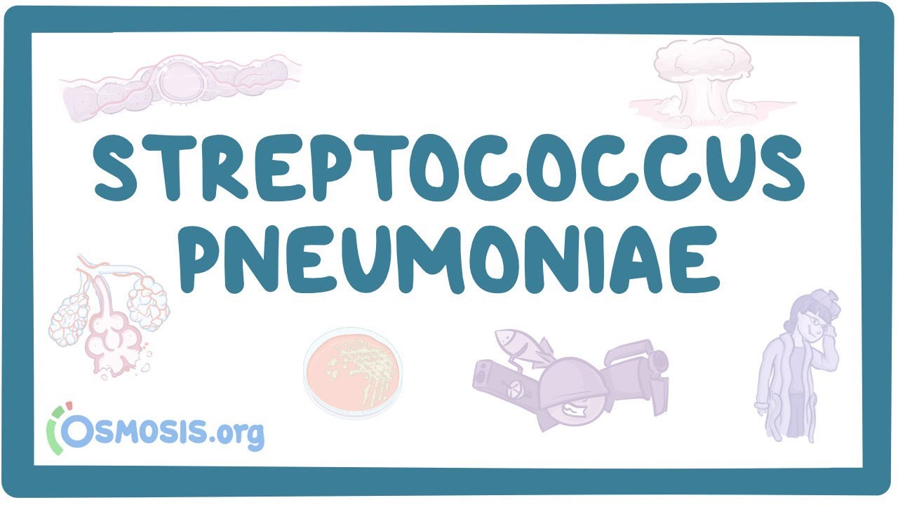 Streptococcus pneumoniae: Video, Anatomy & Definition | Osmosis