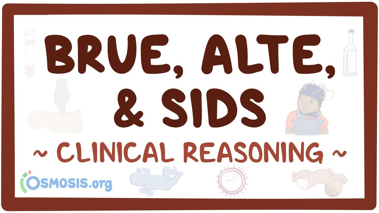 BRUE, ALTE, and SIDS: Clinical: Video, Causes, & Meaning | Osmosis