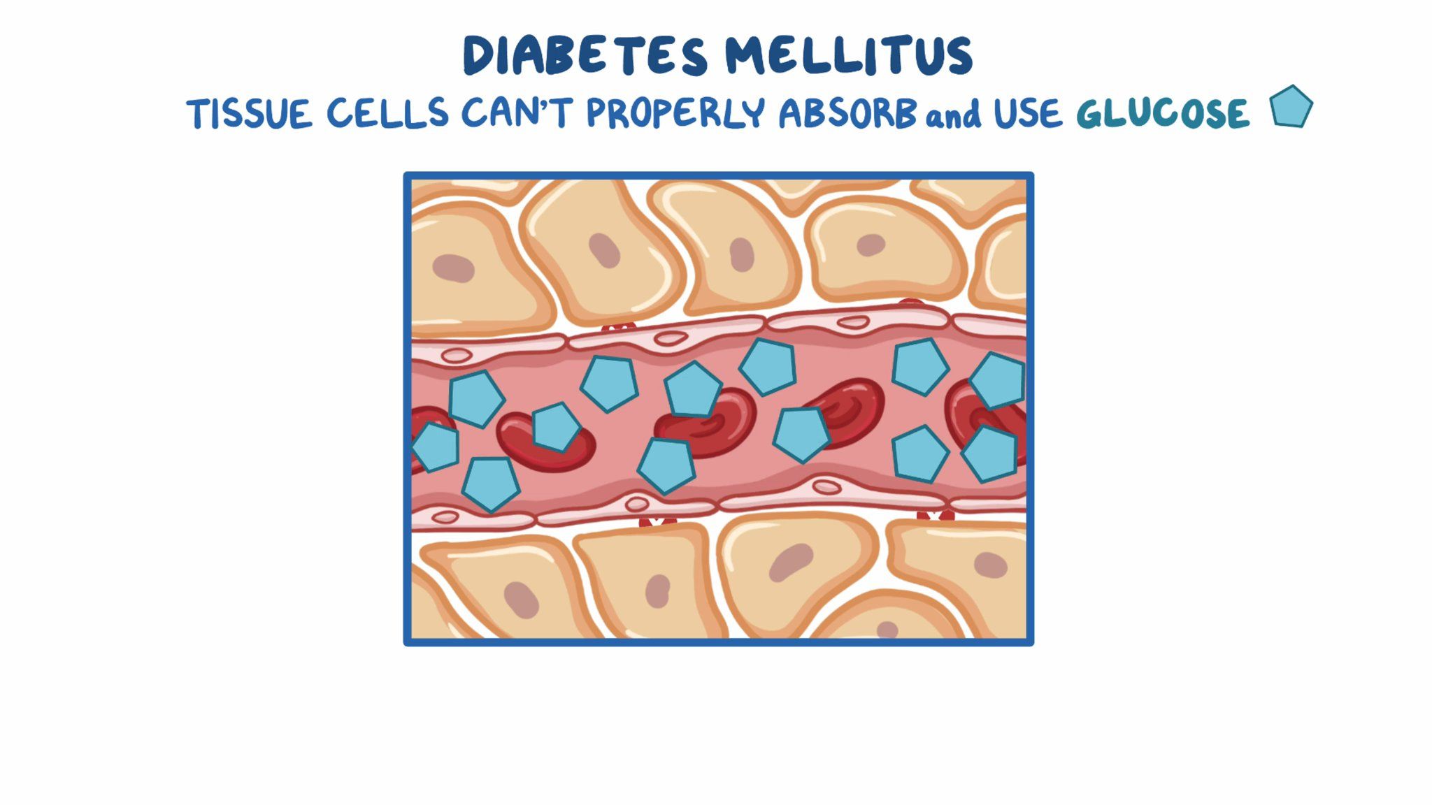 Diabetes mellitus (Type 1): Clinical sciences - Osmosis Video Library