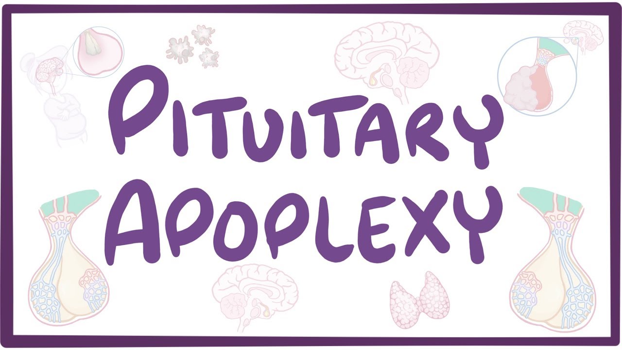 Pituitary apoplexy: Video, Causes, & Meaning | Osmosis