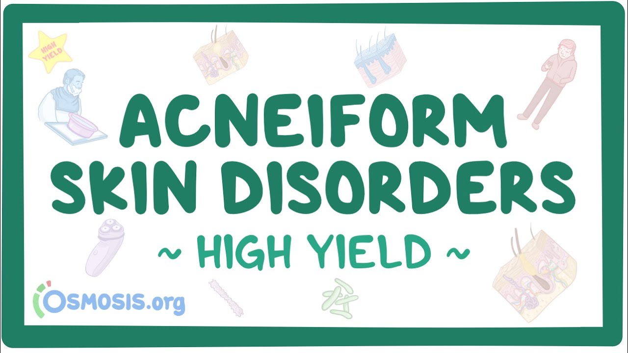 Acneiform skin disorders: Pathology review: Video, Causes, & Meaning ...