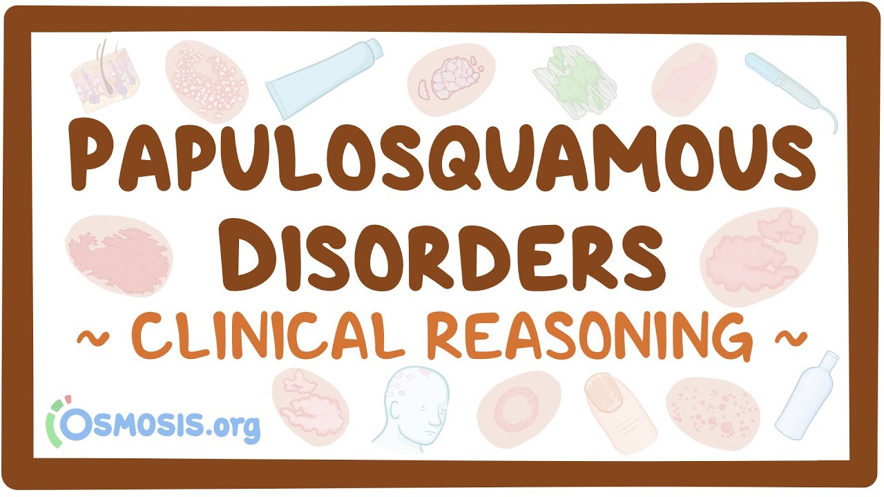 Papulosquamous skin disorders: Clinical: Vídeo | Osmosis