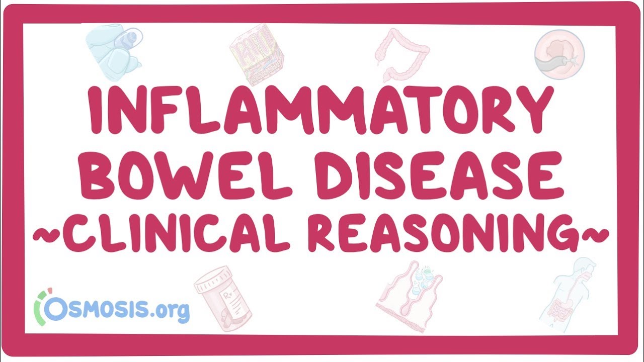 Inflammatory bowel disease: Clinical: Video, Causes, & Meaning | Osmosis